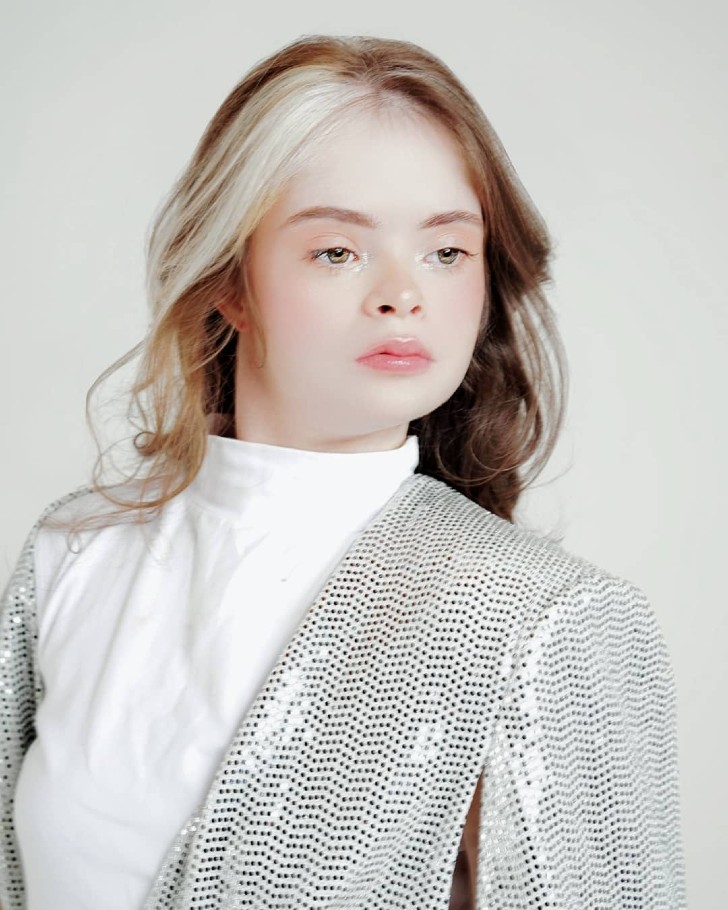 Jessica, la modelo Down venezolana que conquista pasarelas y campañas ...